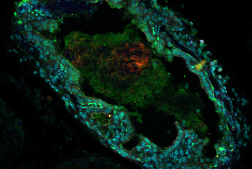 Secrets To Analyzing Spatial Biology Data